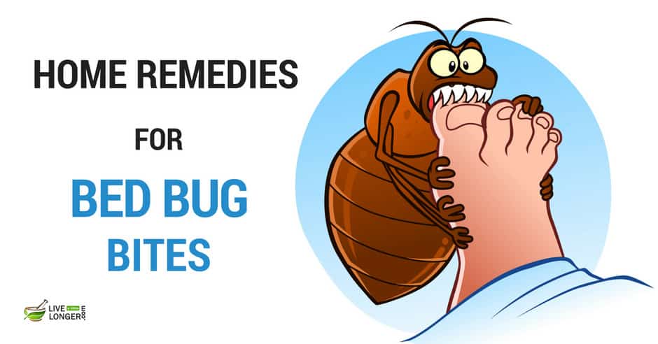 10 Best Home Remedies For Bed Bugs - Bed Bugs Sprays